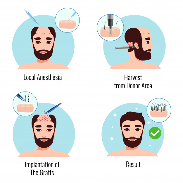 Prime Hair Studio & Cosmetic Clinic : Hair Transplant